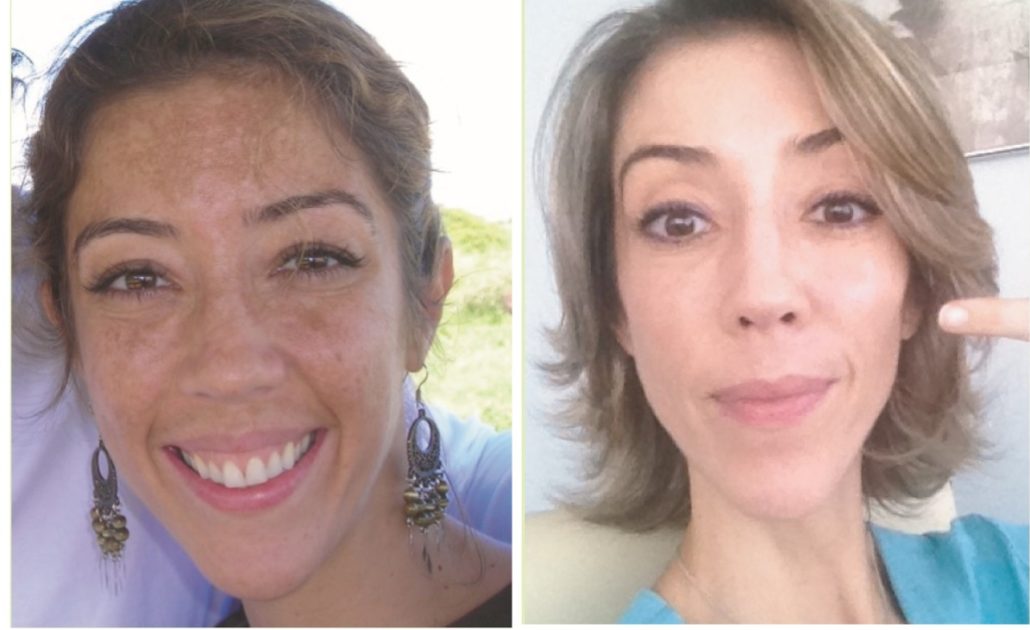 Gleaming Skin | Clínica Estética Carvajal